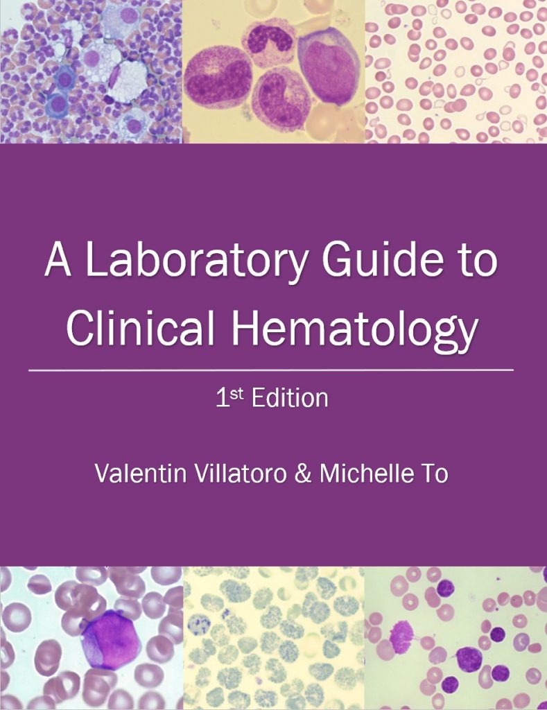 A Laboratory Guide to Clinical Hematology – Simple Book Publishing